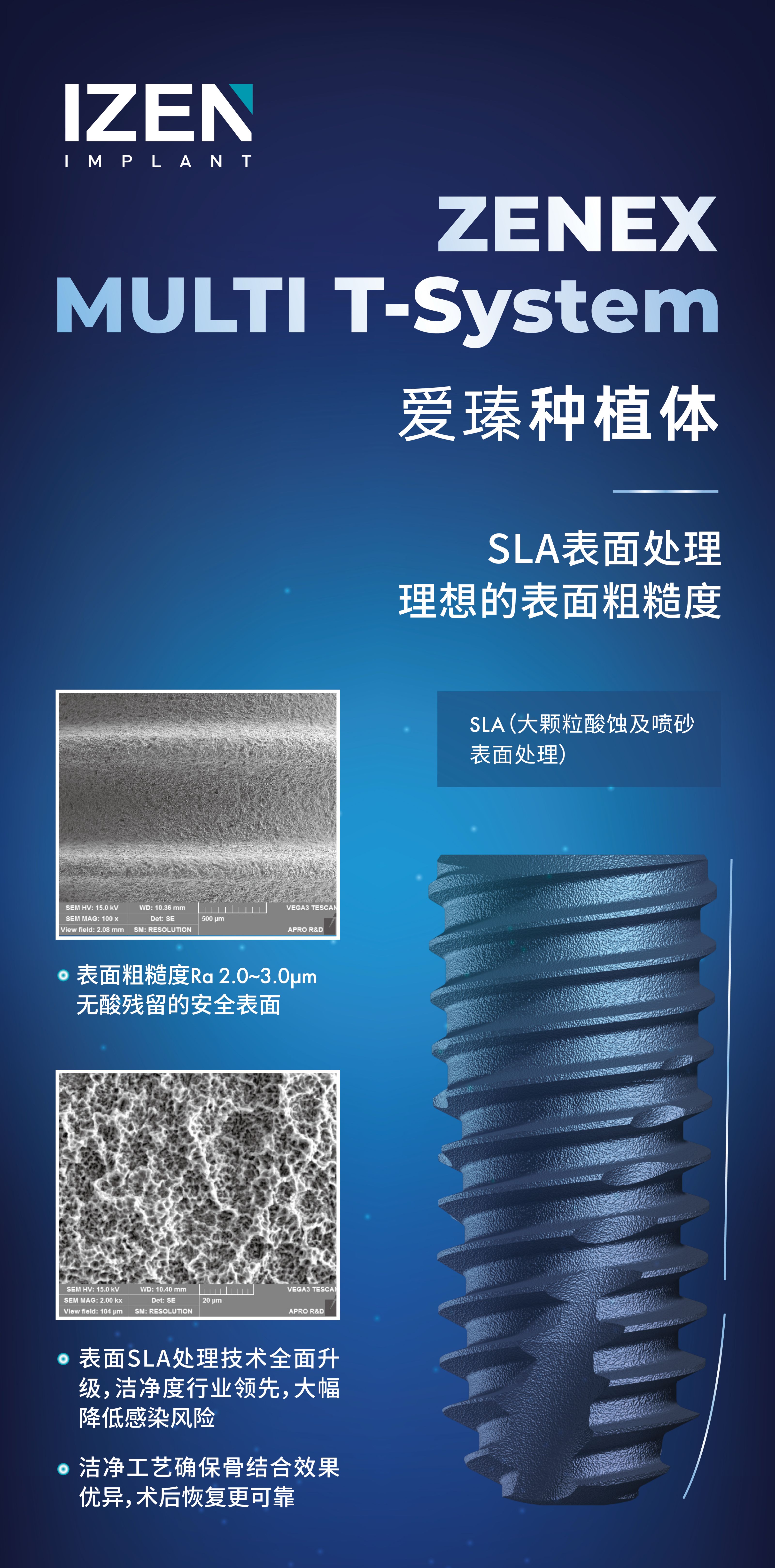 爱瑧IZEN（又名：爱臻）种植体进入中国，洁净技术引领韩系品牌再升级|界面新闻